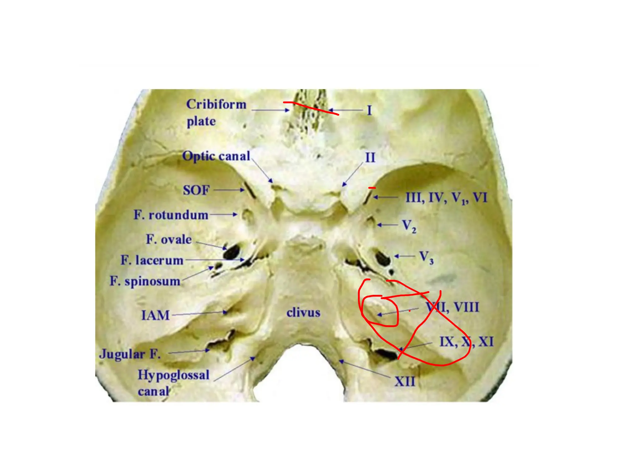 Cranial cavity Meninges and the dural sinuses.pdf