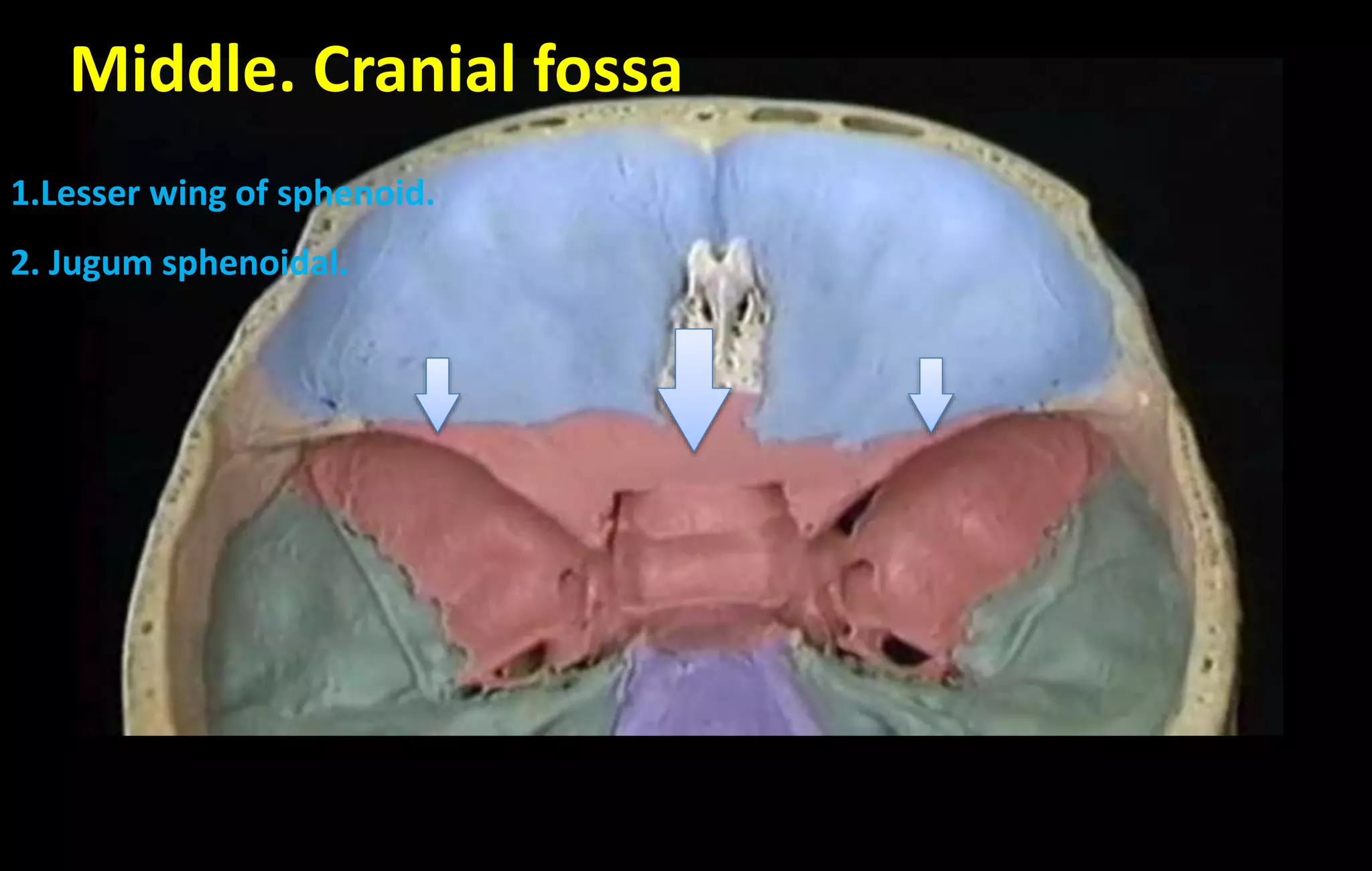 Cranial cavity + skull cap | PPTX | Death, Injury, or Military Conflict ...