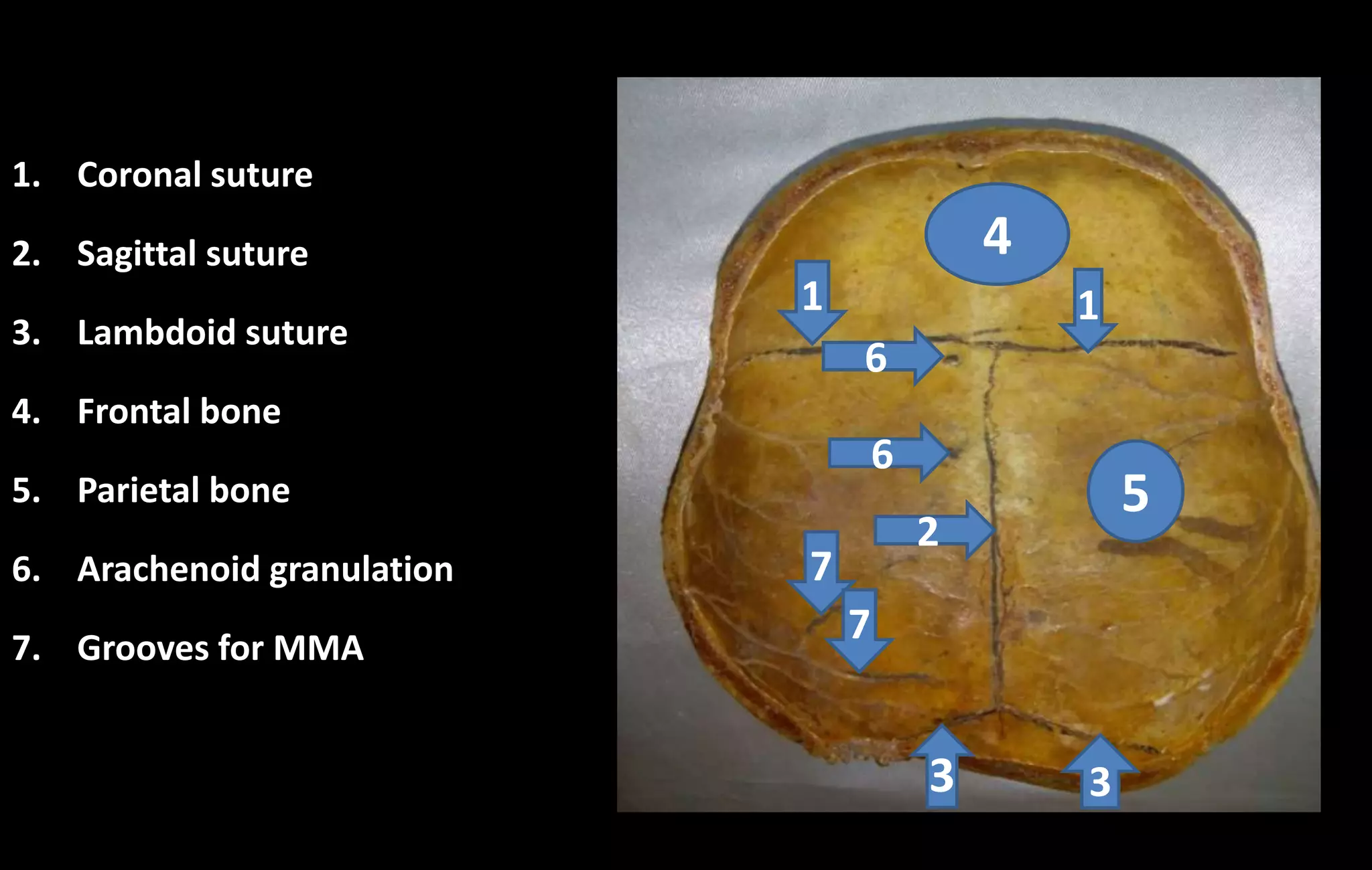 Cranial cavity + skull cap | PPTX