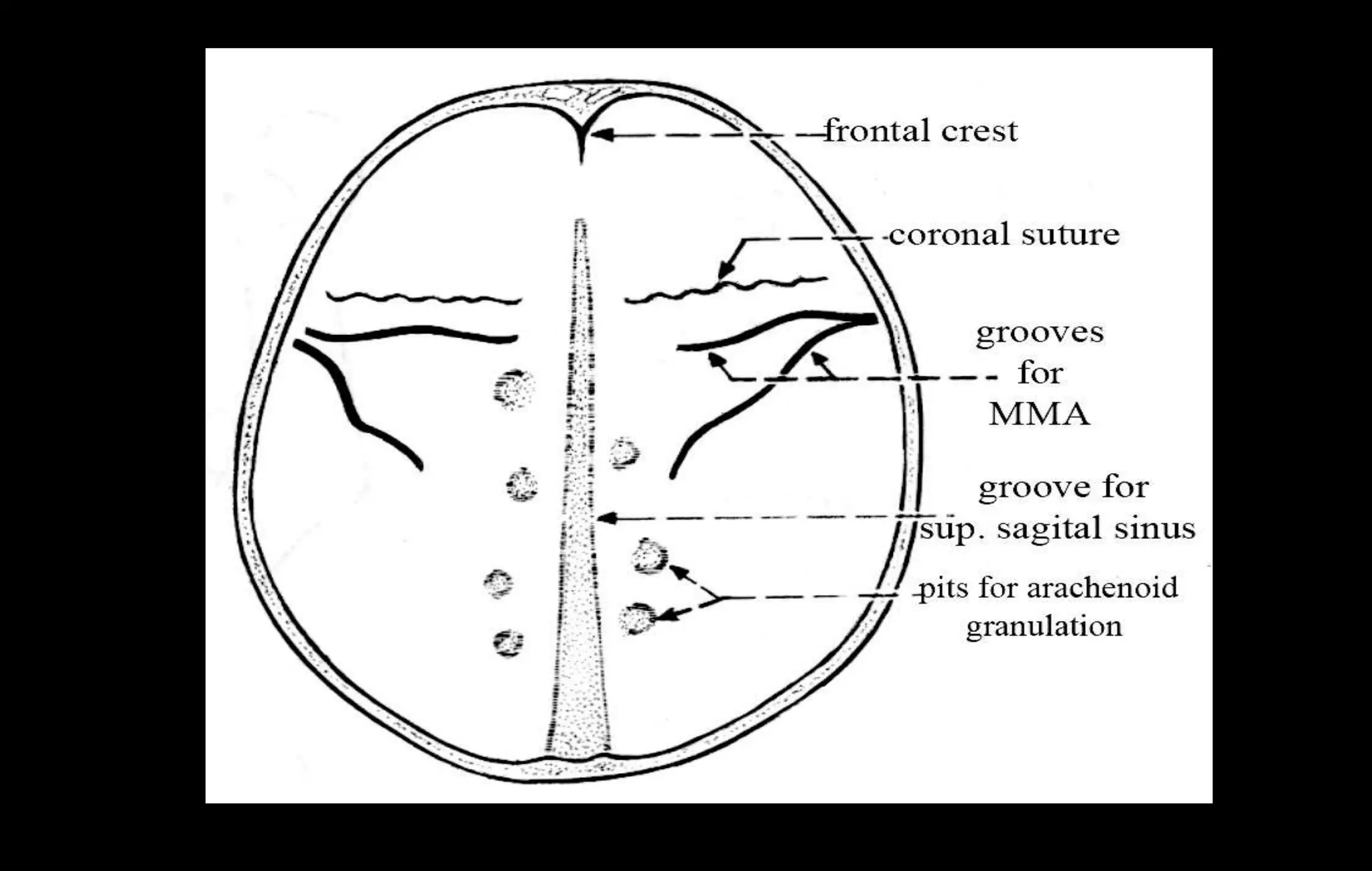 Cranial cavity + skull cap | PPTX
