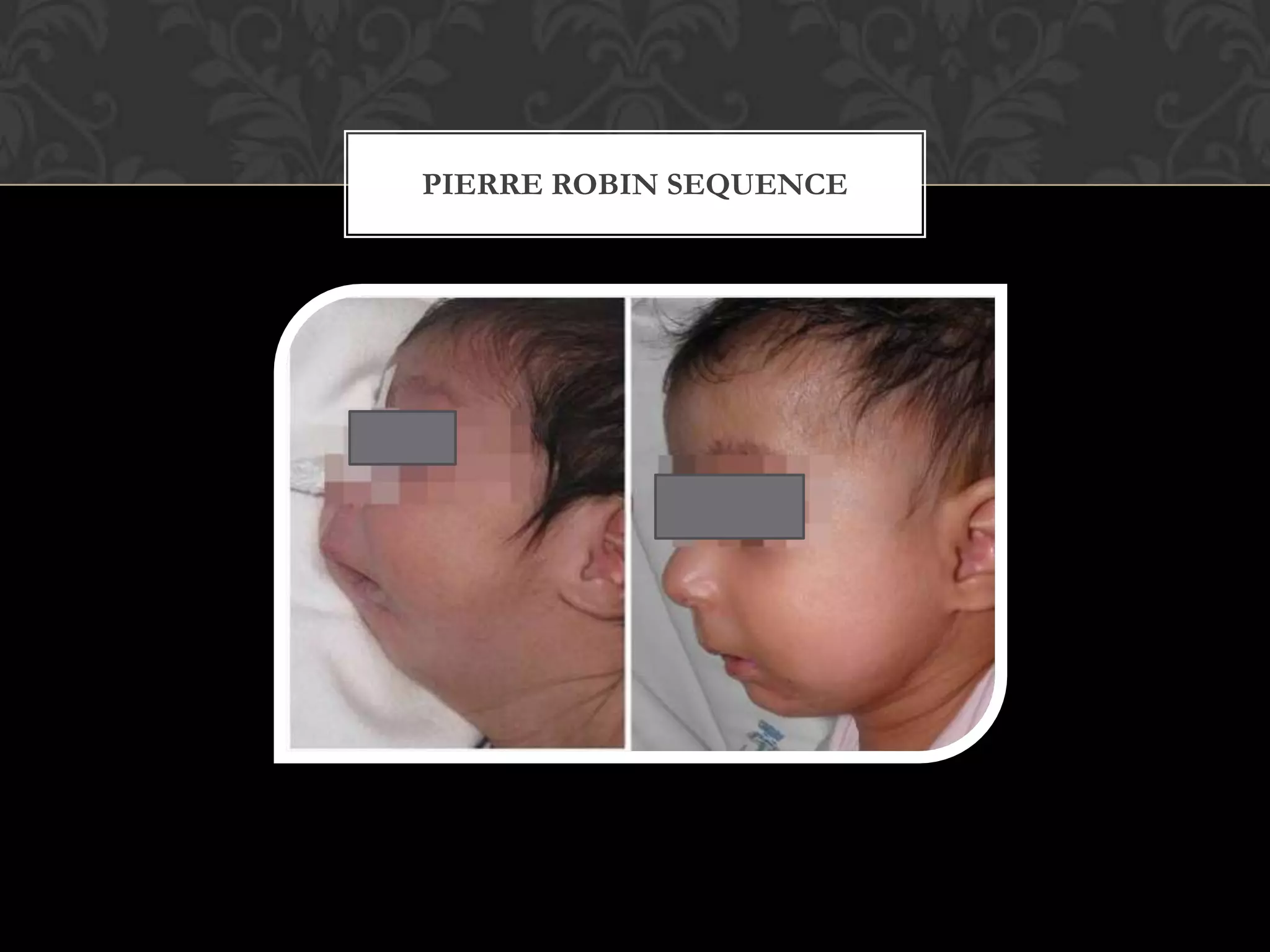 Cranial Deformitas | PPTX