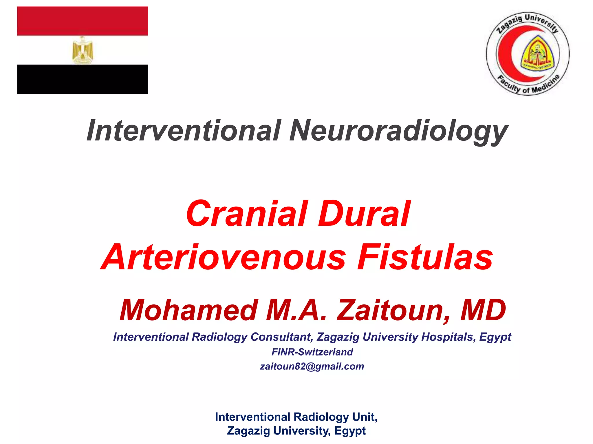 Cranial dural arteriovenous fistulas | PPT