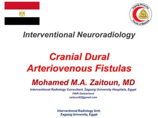 Cranial dural arteriovenous fistulas | PPT