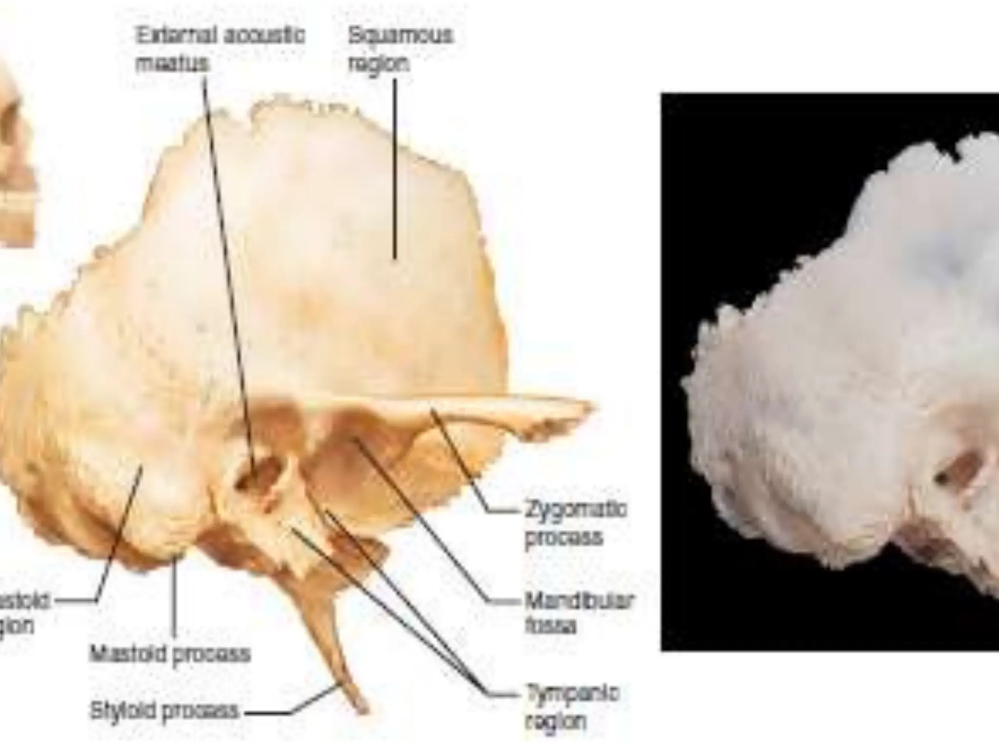Cranial, facial bones with location in body | PPTX