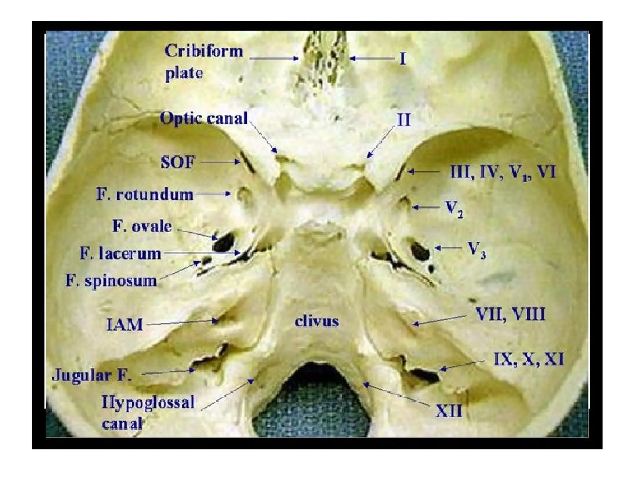 Cranial fossae in base of the human skull | PDF