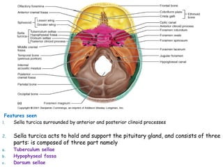 anatomy of the Cranial fossae of the skull.pptx