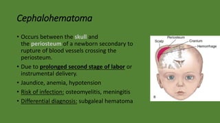 Cranial hematomas (injury) | PPTX