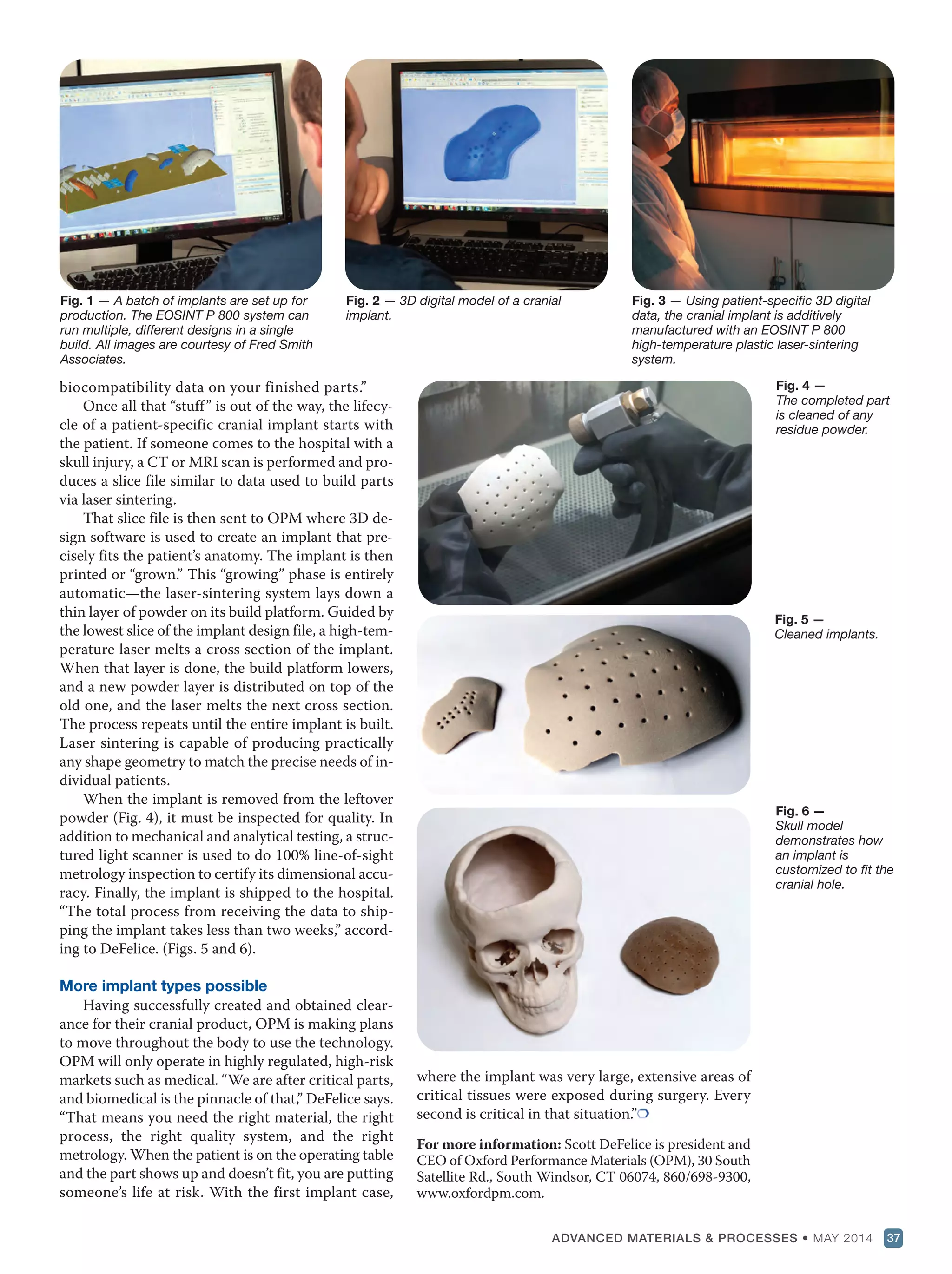 Cranial implants by OMP with EOS SLS Additive Manufacturing / 3D ...