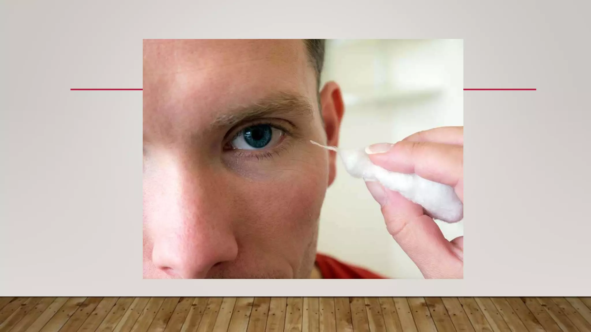 Examination of Cranial nerves - Pediatrics | PPTX