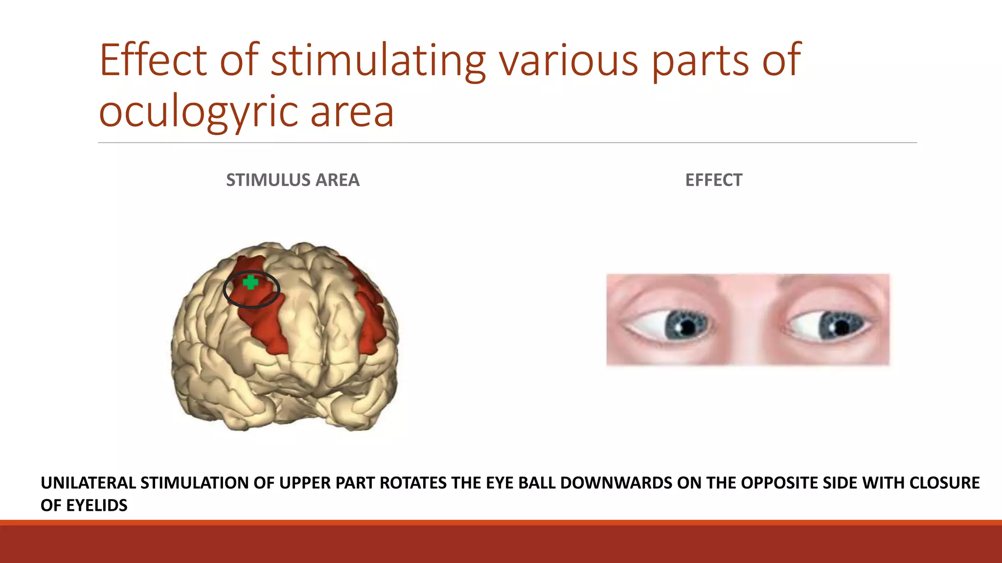SIXTH CRANIAL NERVE PALSY- Diagnosis and management | PPTX