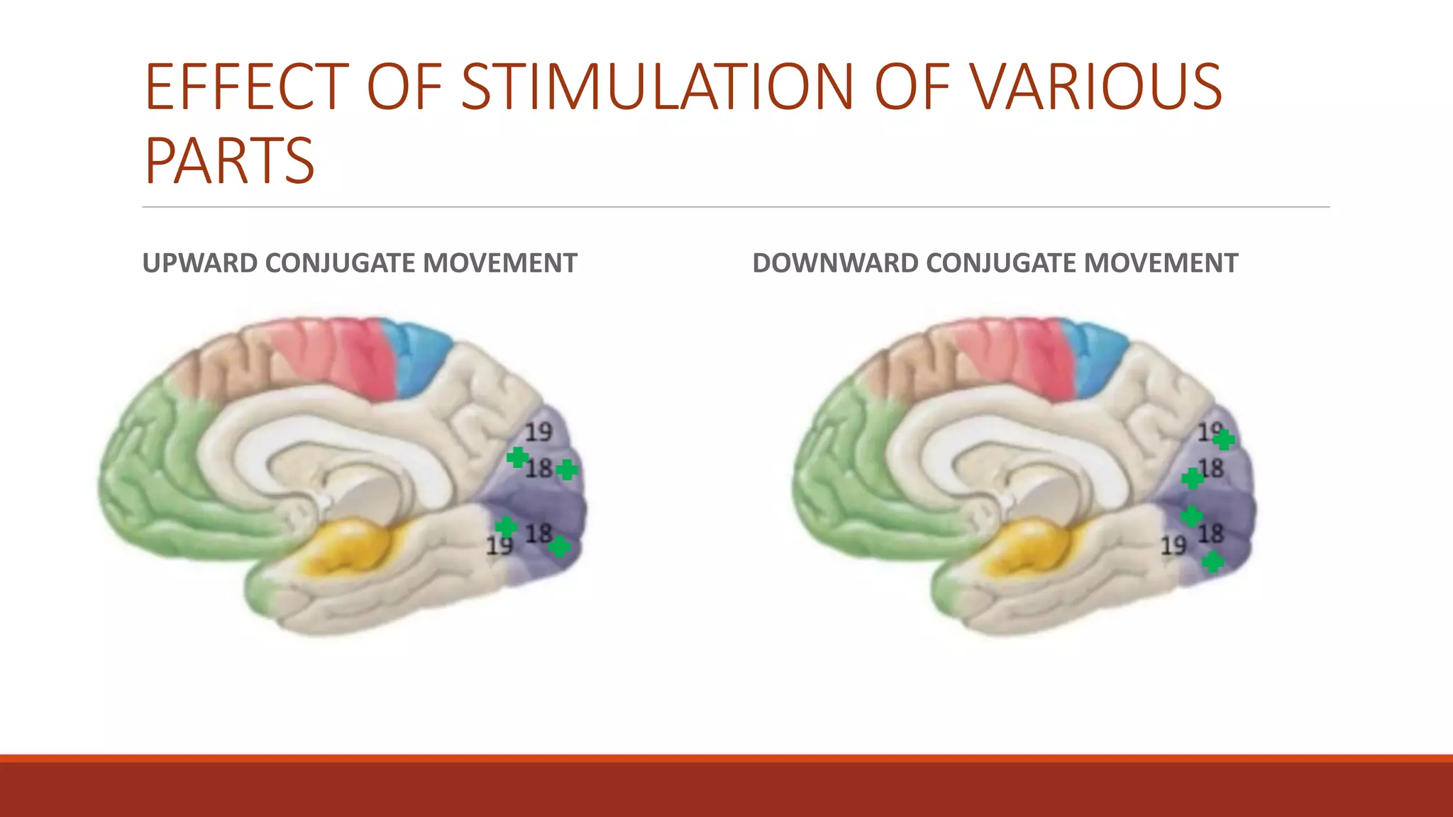 SIXTH CRANIAL NERVE PALSY- Diagnosis and management | PPTX