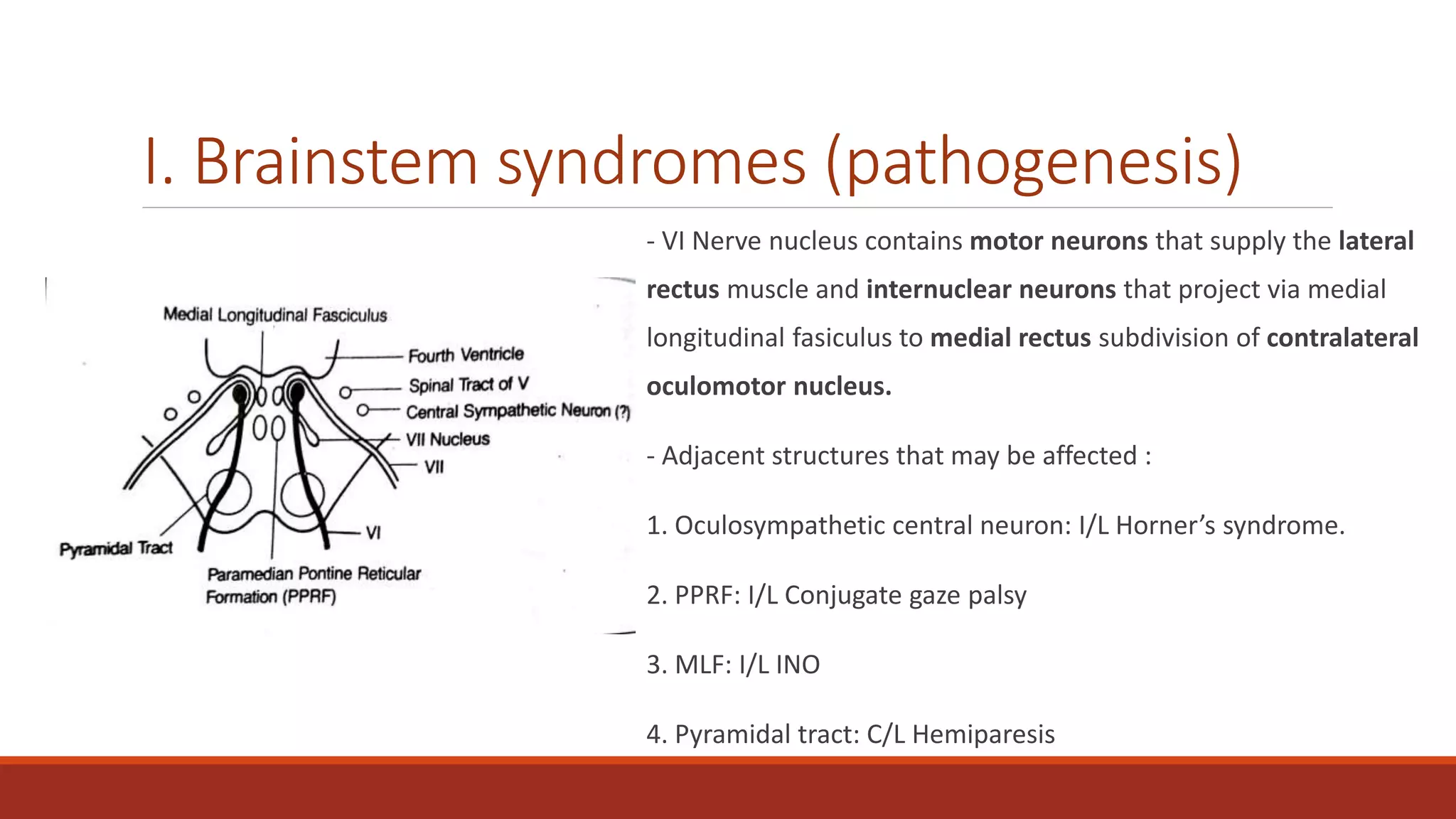 SIXTH CRANIAL NERVE PALSY- Diagnosis and management | PPTX