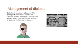 SIXTH CRANIAL NERVE PALSY- Diagnosis and management | PPTX