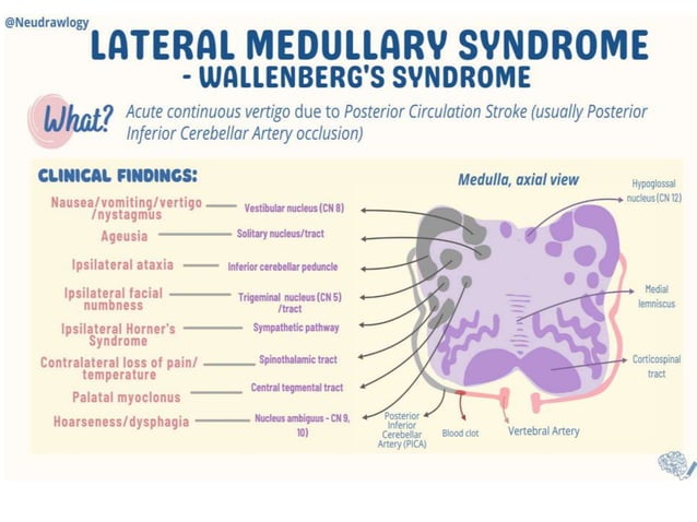CRANIAL NERVE 9 (GLOSSOPHARYNGEAL) & CRANIAL.pptx | Ear, Nose and ...