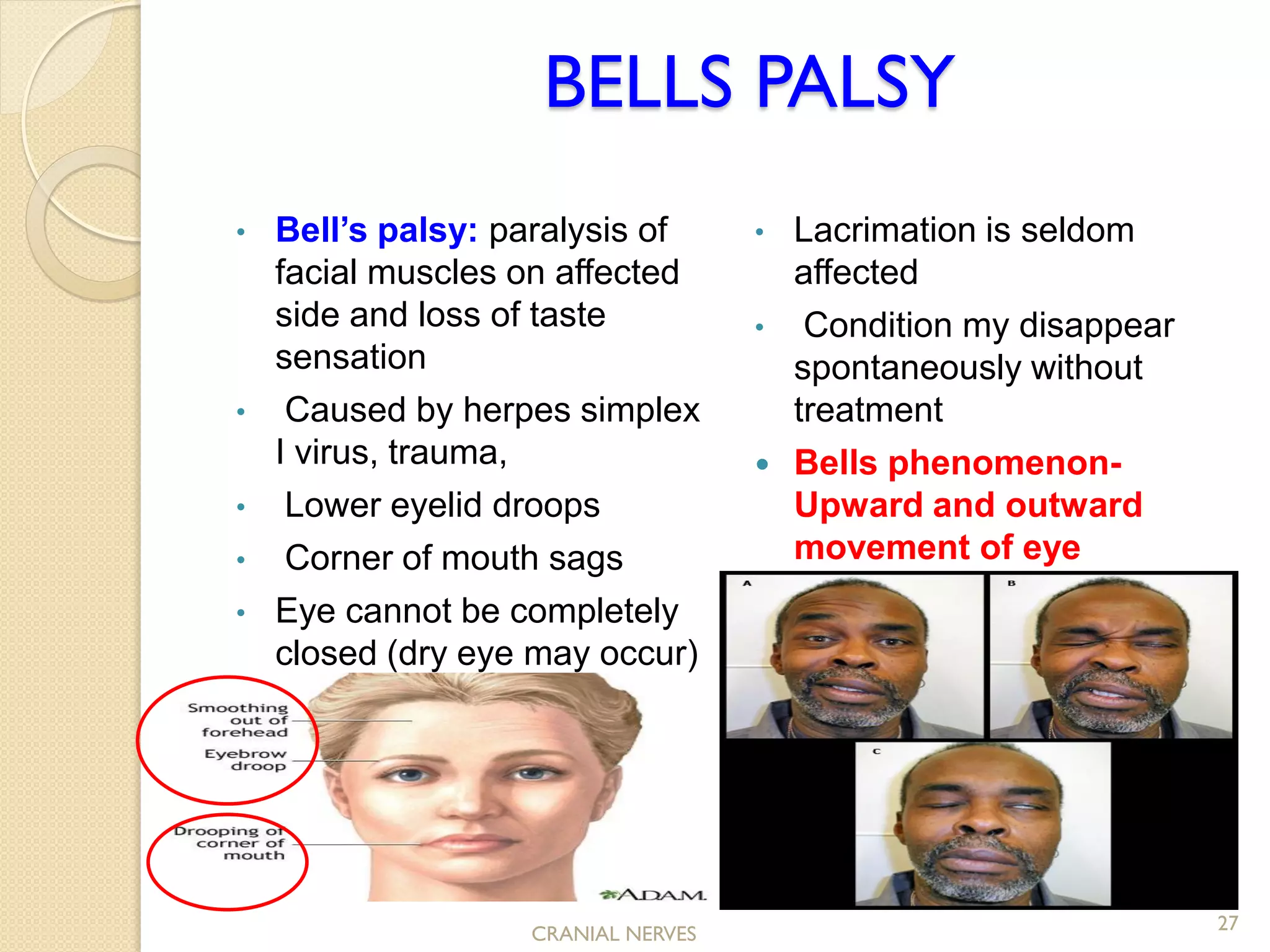 Cranial nerve assessment..Simple and Easy to perform for medics and ...