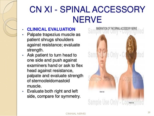 Cranial nerve assessment..Simple and Easy to perform for medics and P…