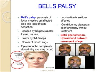 CRANIAL NERVE ASSESSMENT final.ppt