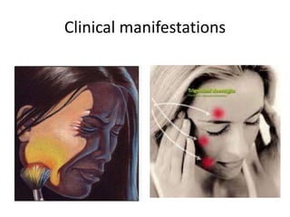 Cranial nerve disorders | PPTX