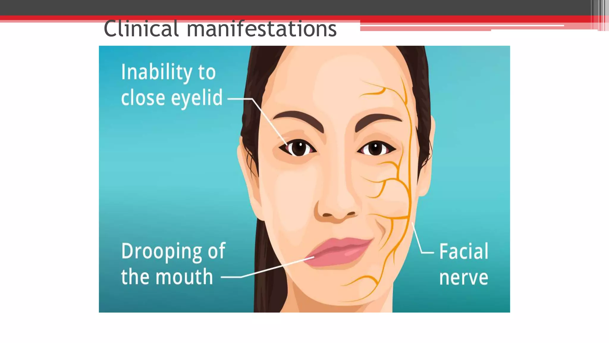 Cranial nerve disorders | PPTX