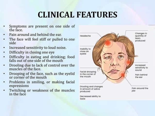 CRANIAL NERVE DISORDERS