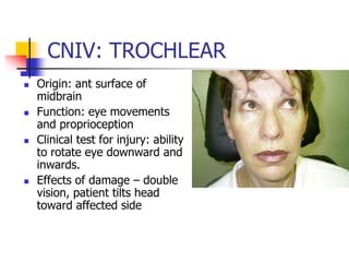 Cranial nerve examination | PPTX