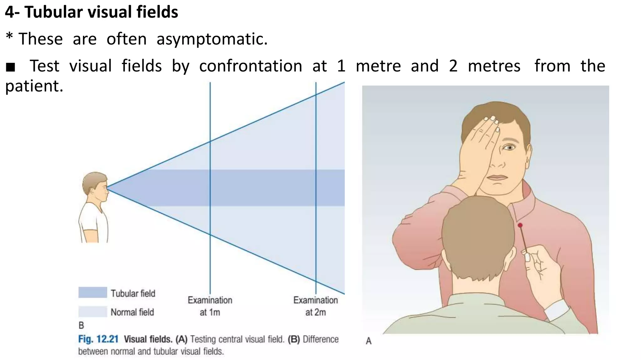 Cranial nerve examination | PPTX