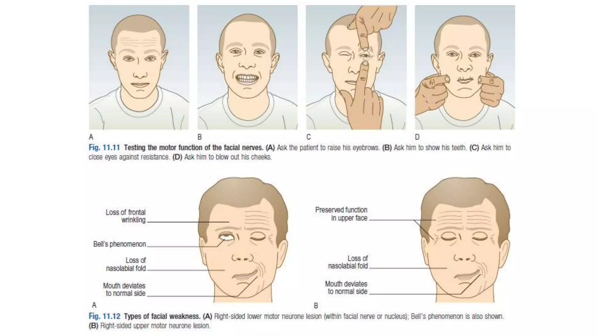 Cranial nerve examination | PPTX