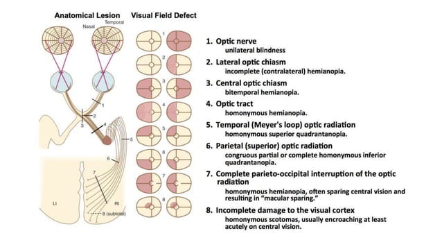 Cranial nerve examination | PPTX | Eye and Vision Conditions | Diseases and Conditions