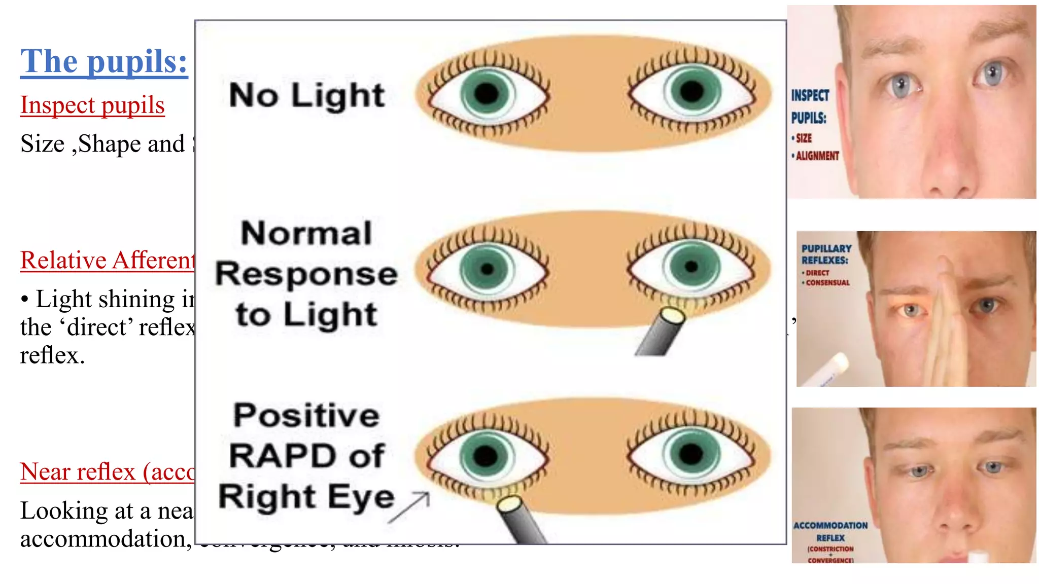 Cranial nerves examination.... | PPTX