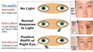 Cranial nerves examination.... | PPTX