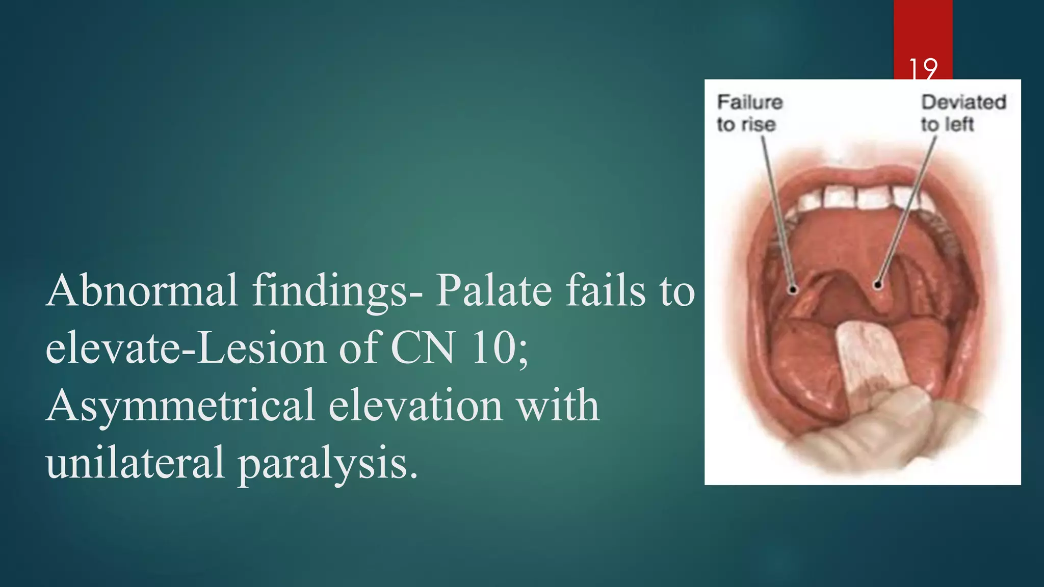 Cranial Nerve Examination | PDF