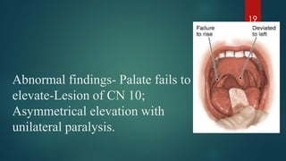 Cranial Nerve Examination | PDF