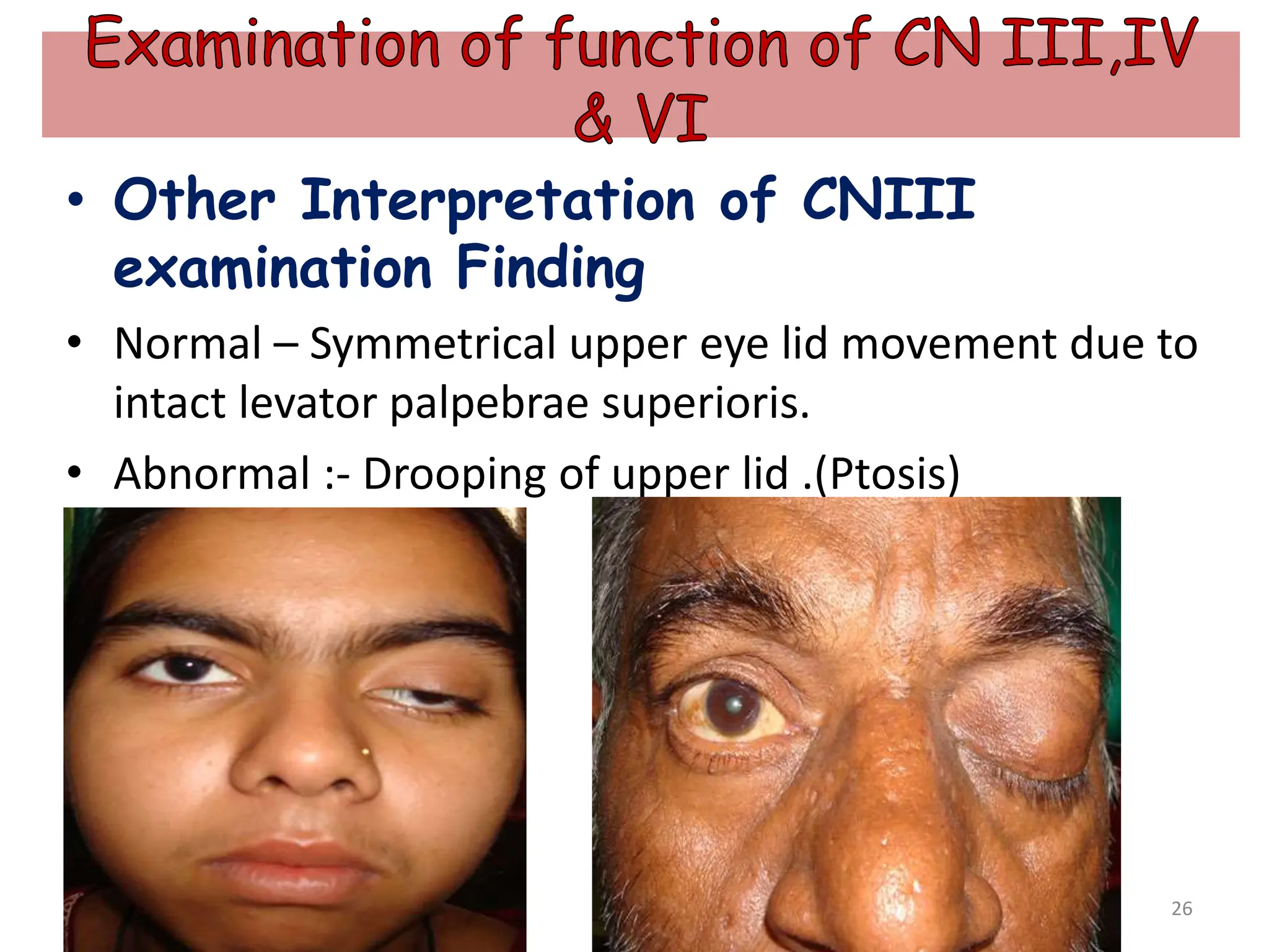 Cranial nerve examination.pptx