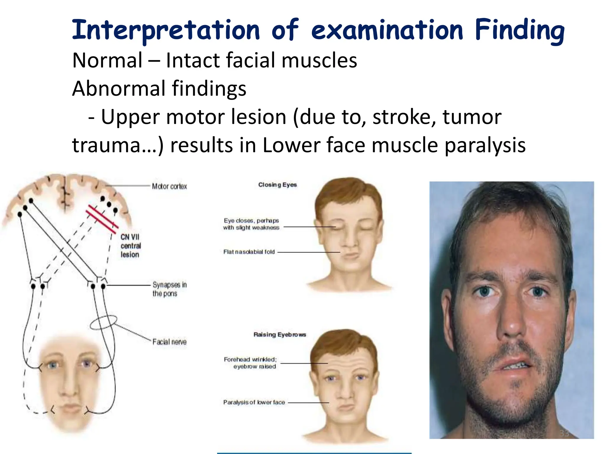 Cranial nerve examination.pptx