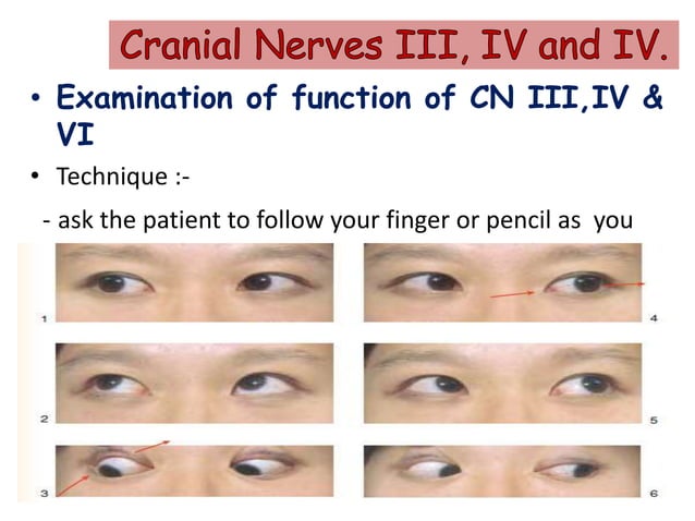 Cranial nerve examination.pptx