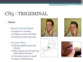 Neurological Examination : Cranial Nerve Examination Lecture 4 | PDF