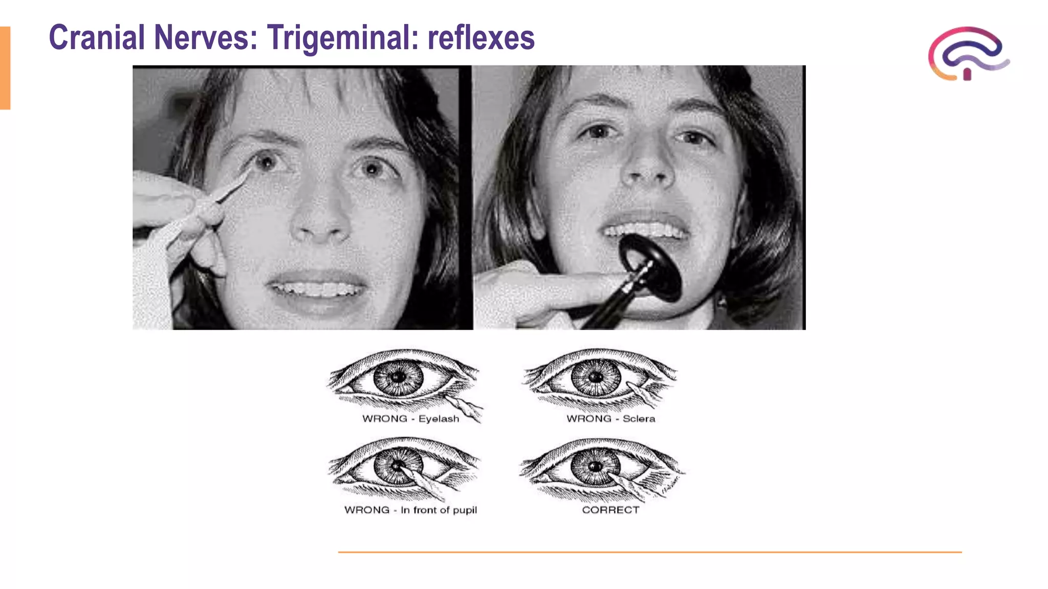 cranial nerve examination & theoritical | PPTX | Eye and Vision ...