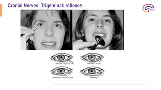 cranial nerve examination & theoritical | PPTX | Eye and Vision ...