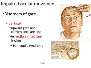 cranial nerve examination and lesions.pptx