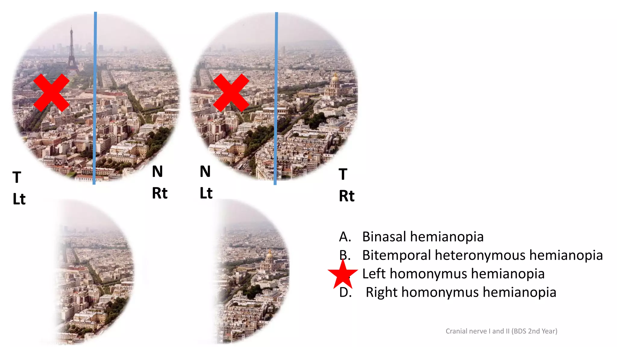Cranial nerve I and II | PDF
