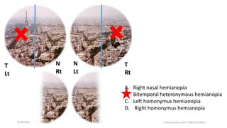Cranial nerve I and II | PDF