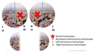 Cranial nerve I and II | PDF