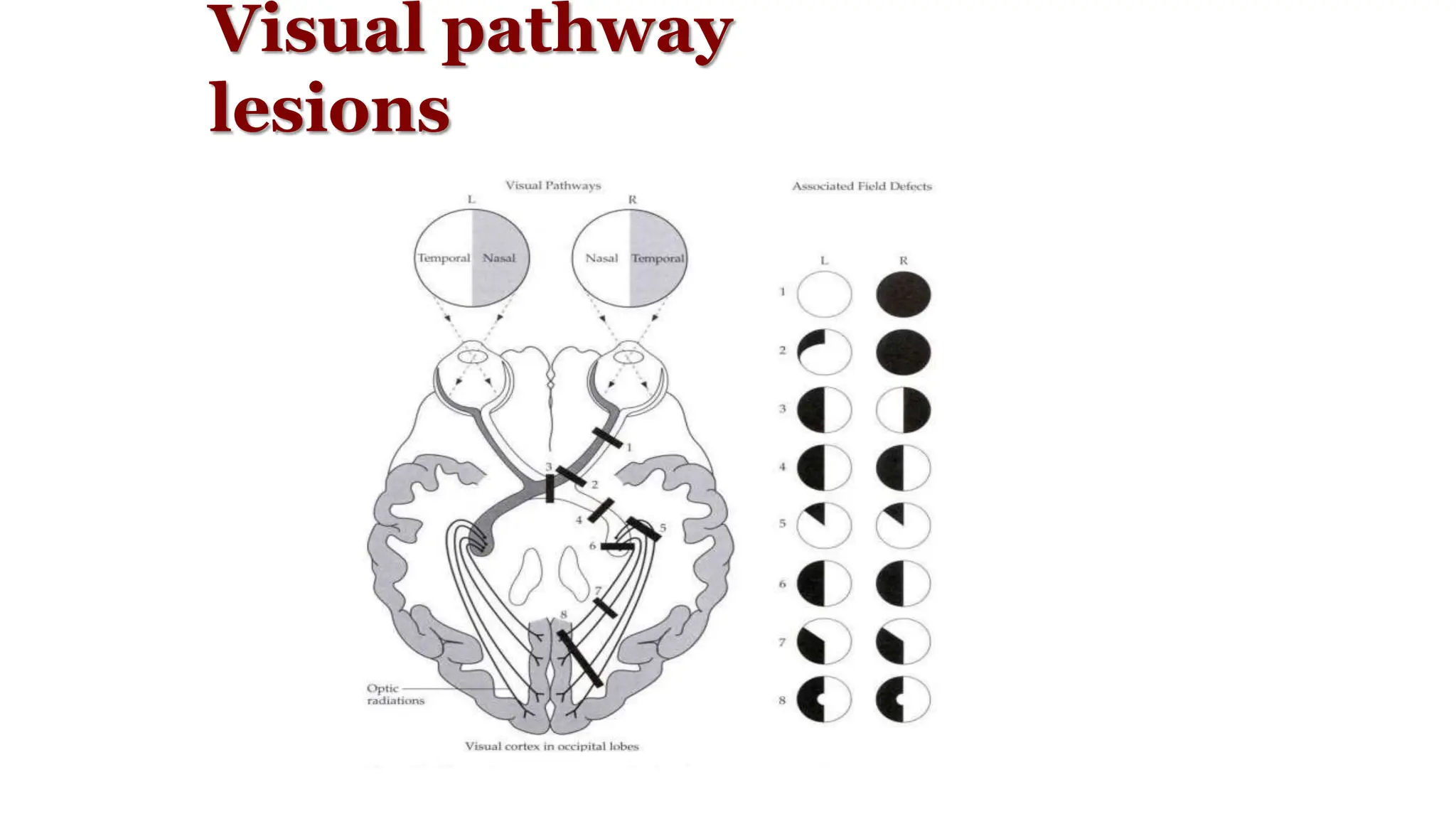 Cranial Nerve II and Visual Pathways.pptx
