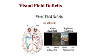 Cranial Nerve II and Visual Pathways.pptx