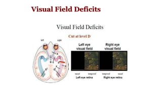Cranial Nerve II and Visual Pathways.pptx