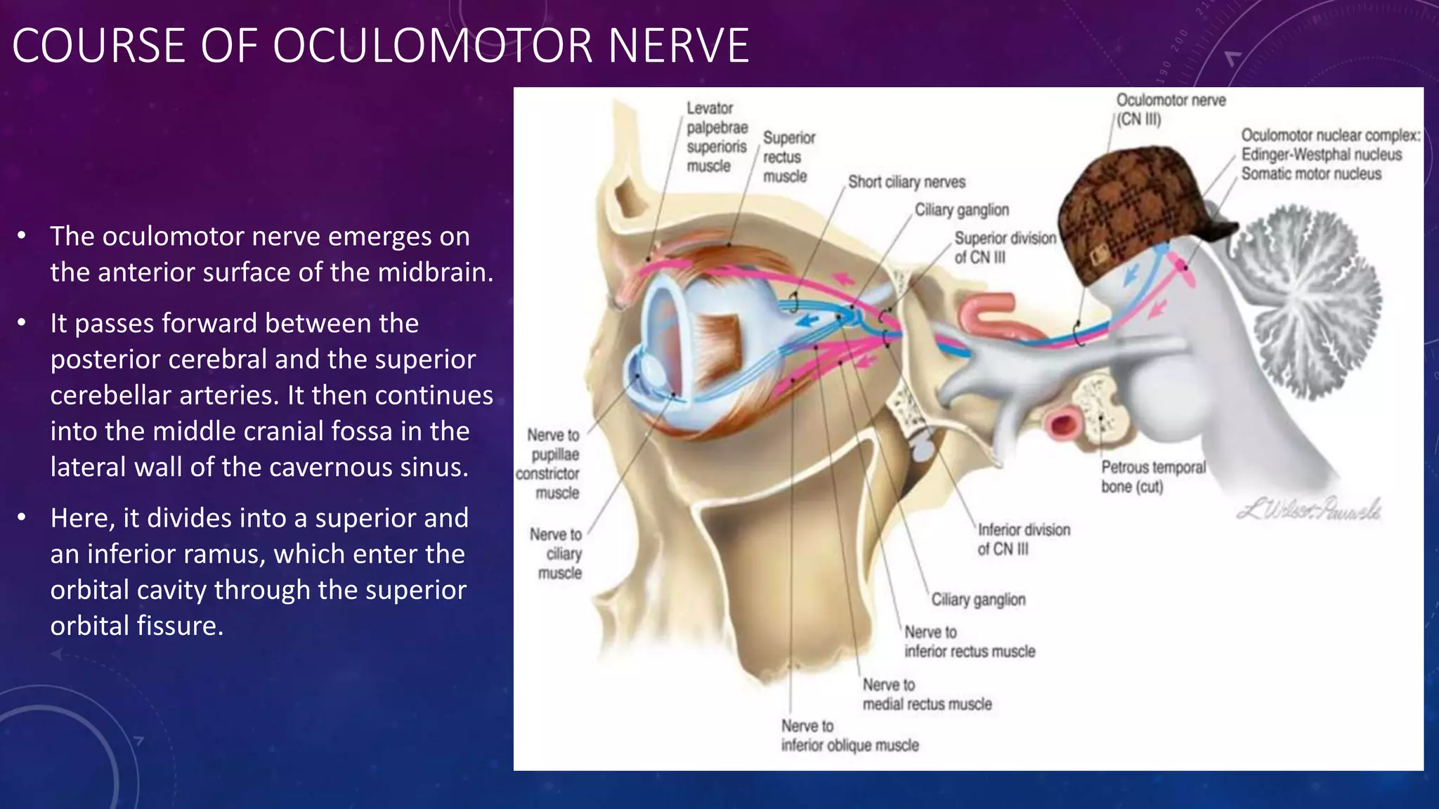 Cranial nerve i ii iii iv combined presentation | PPTX