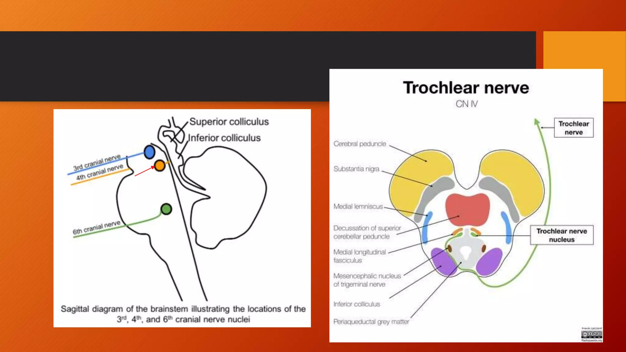 Cranial Nerve III, IV and VI Neuroanatomy.pptx