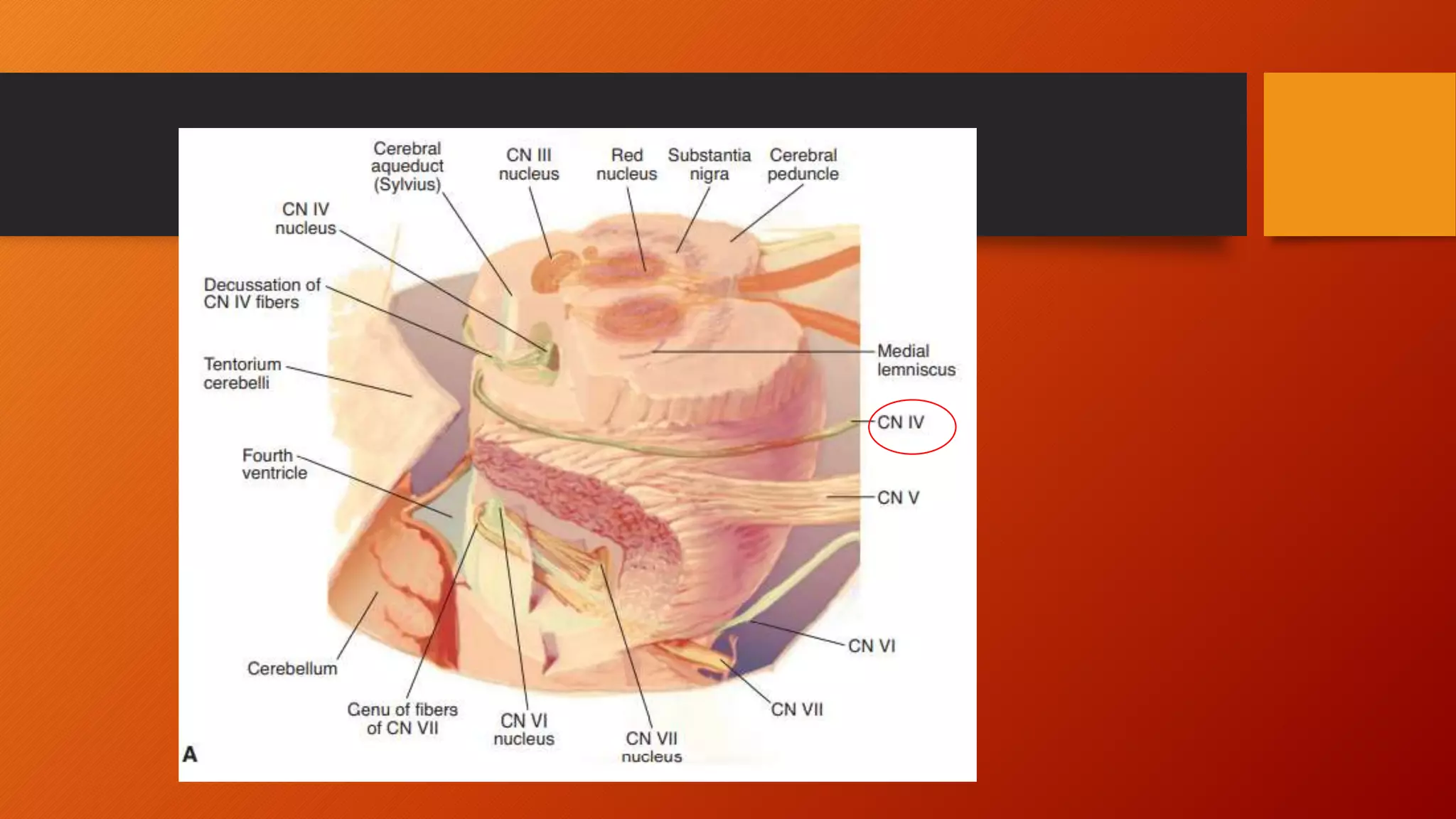 Cranial Nerve III, IV and VI Neuroanatomy.pptx