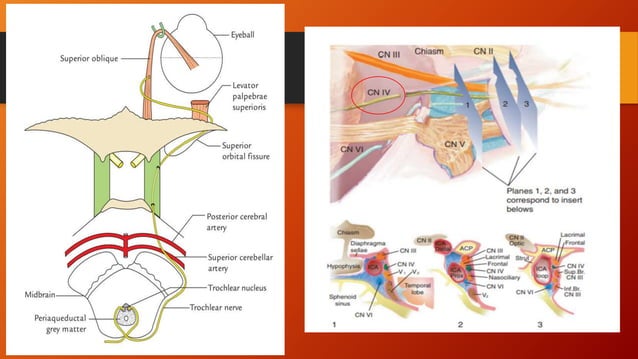 Cranial Nerve III, IV and VI Neuroanatomy.pptx