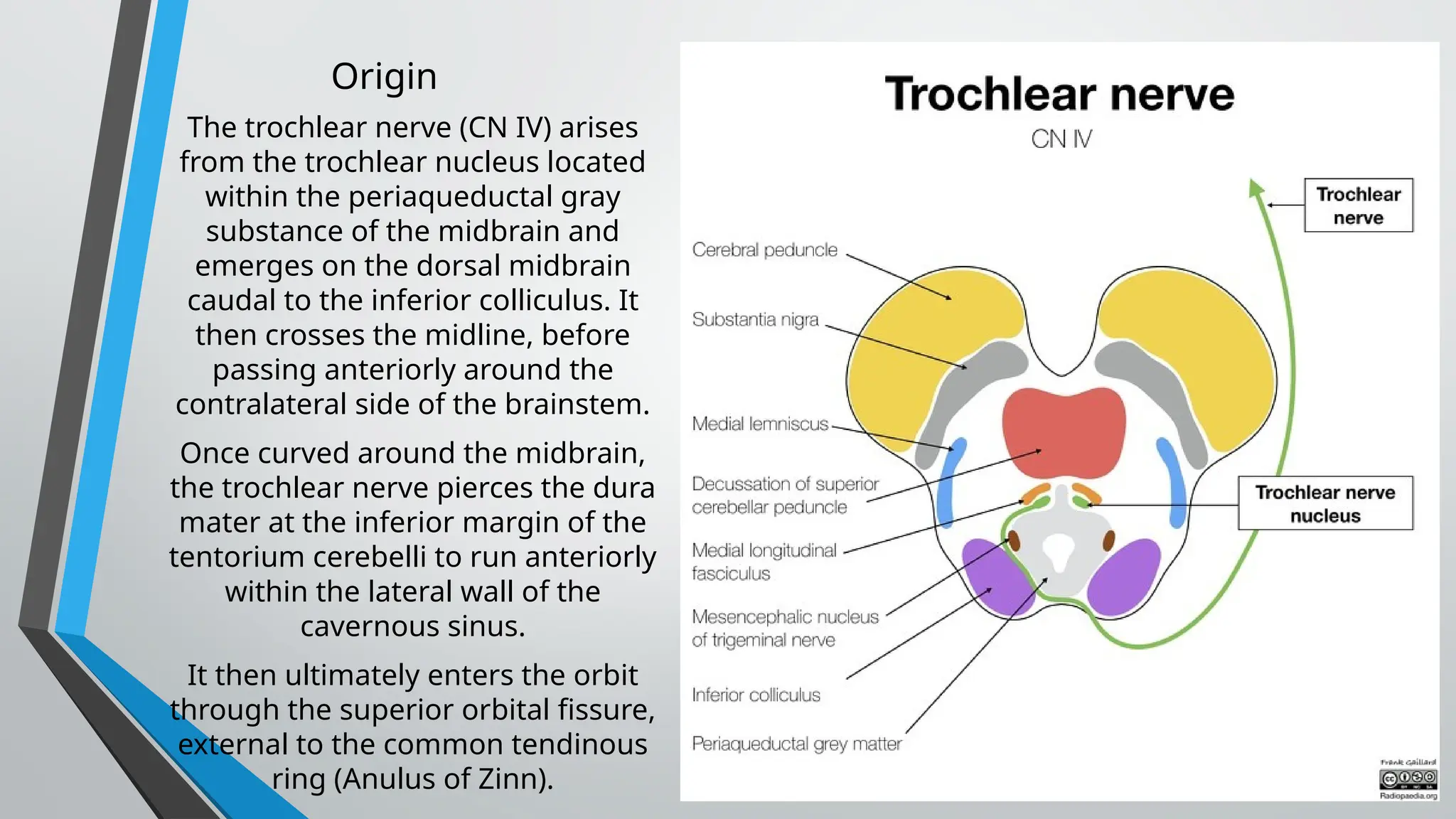 Notes of Cranial Nerve: III, IV, VI.pptx